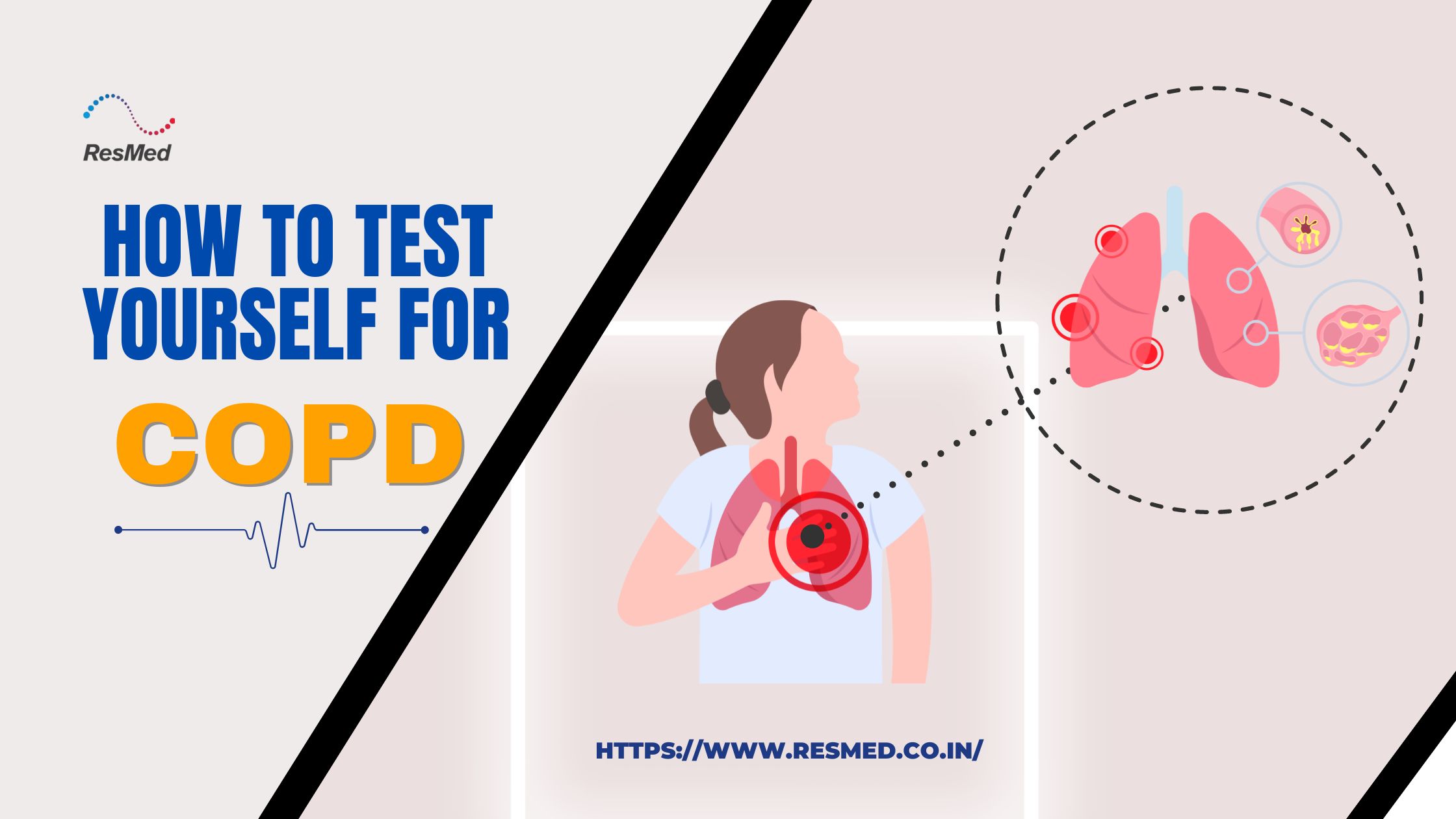 How to Test Yourself For COPD?