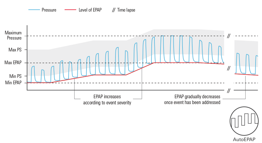 ResMed’s non-invasive ventilators suitable for COPD