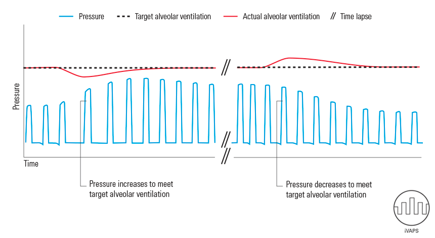 ResMed’s non-invasive ventilators suitable for COPD