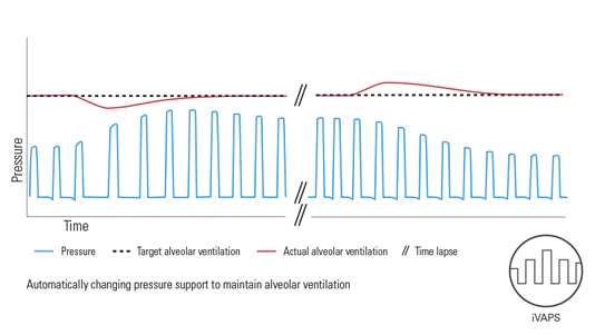 Lumis™ 150 VPAP ST-A non-invasive ventilator| ResMed